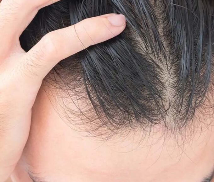 The Impact of Overbite on Mewing: What You Need to Know - DebraBernier